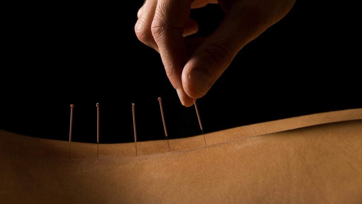 Adult Japanese Acupuncture - Bumblebee AcuTherapy